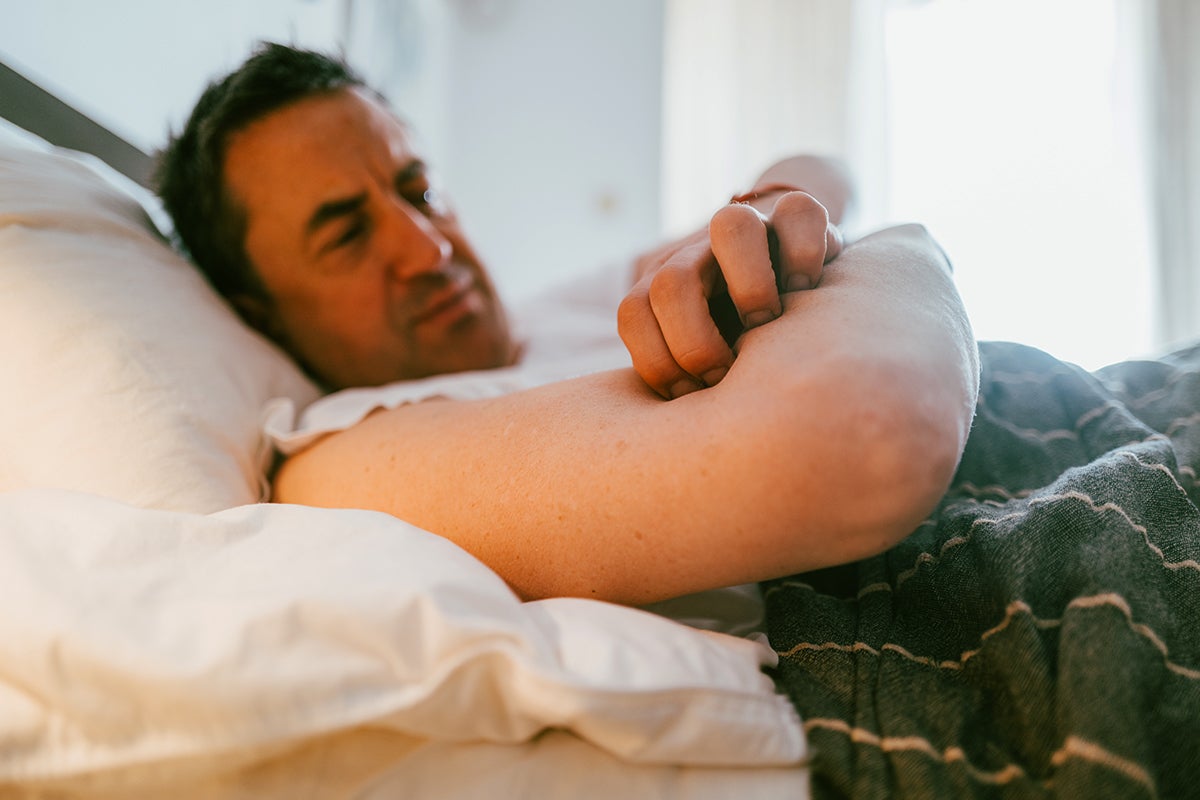 HIV rash: Symptoms, causes, types, and treatments | Optum Perks