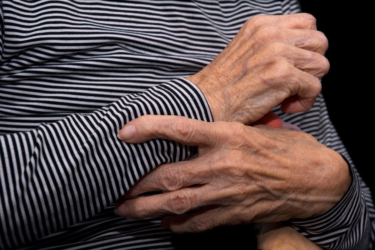 Nail changes with rheumatoid arthritis: What are they? | Optum Perks