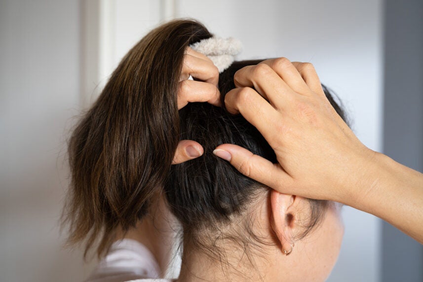 The 3 Stages Of Shingles What To Know Optum Perks