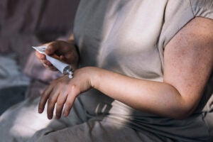 Silver sulfadiazine — How long does it take to work? | Optum Perks